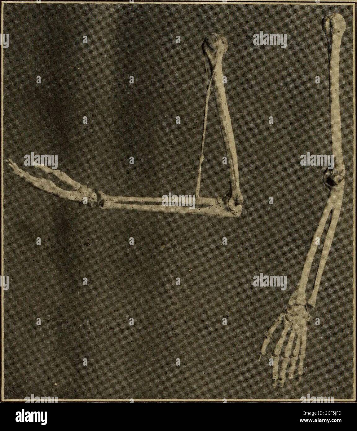 Structure Of Shortening