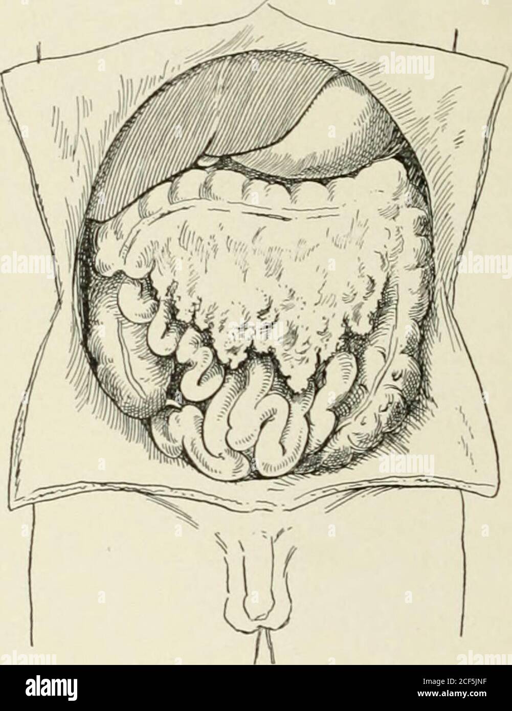 . Abdominal hernia : its diagnosis and treatment. ic artery originated ...