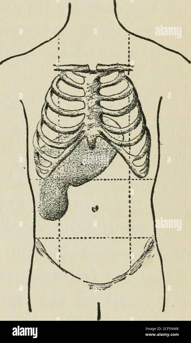 . Lectures on the diagnosis of abdominal tumors, delivered to the post ...