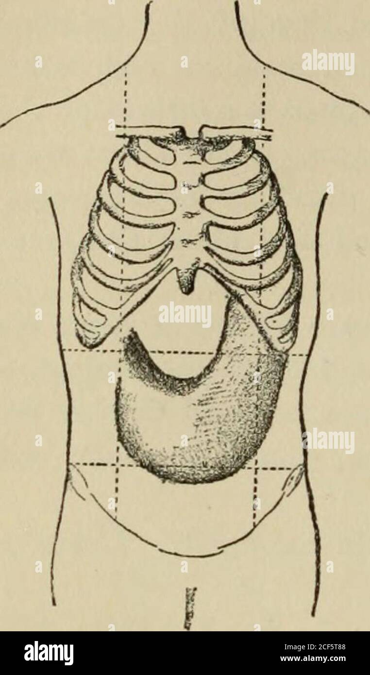 . Lectures on the diagnosis of abdominal tumors, delivered to the post ...