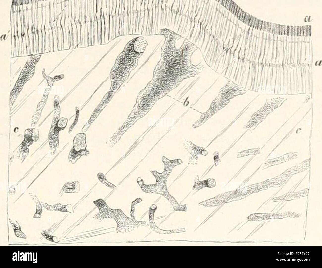 Asbestos needle hi-res stock photography and images - Alamy