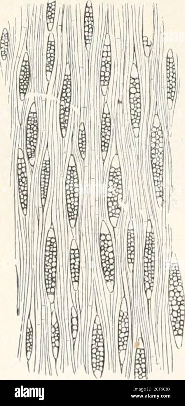 Tracheids Under Microscope