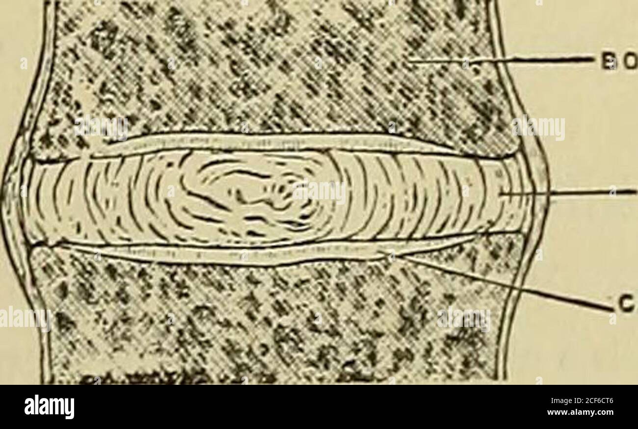 Squamous suture hi-res stock photography and images - Alamy