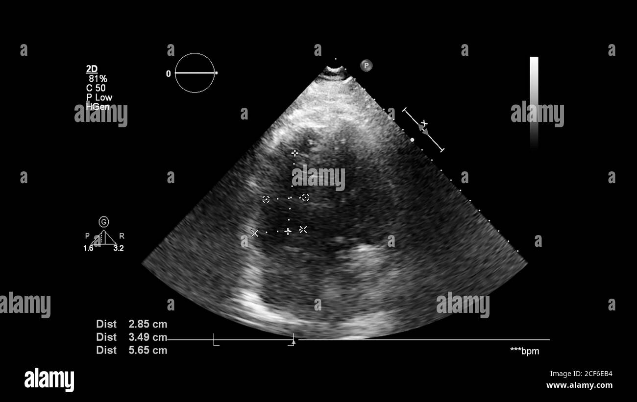 Cavity structure effect Black and White Stock Photos & Images - Alamy