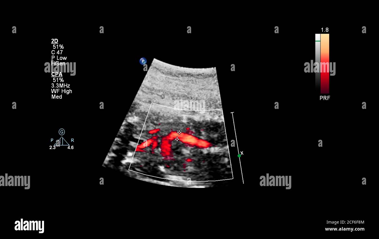Ultrasound screen with fetal echocardiography Stock Photo - Alamy