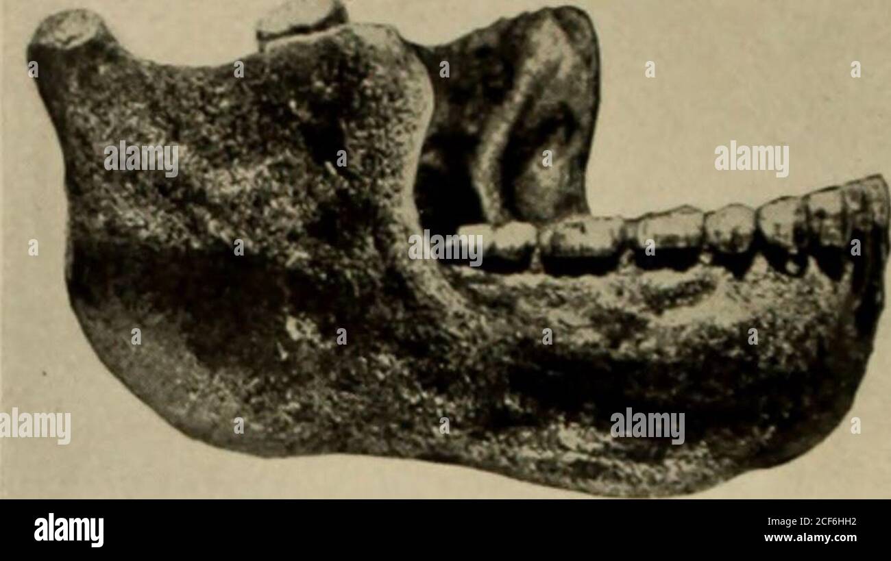 . Guide leaflet. Fig. 7. The Heidelberg jaw. About one-third natural si ...