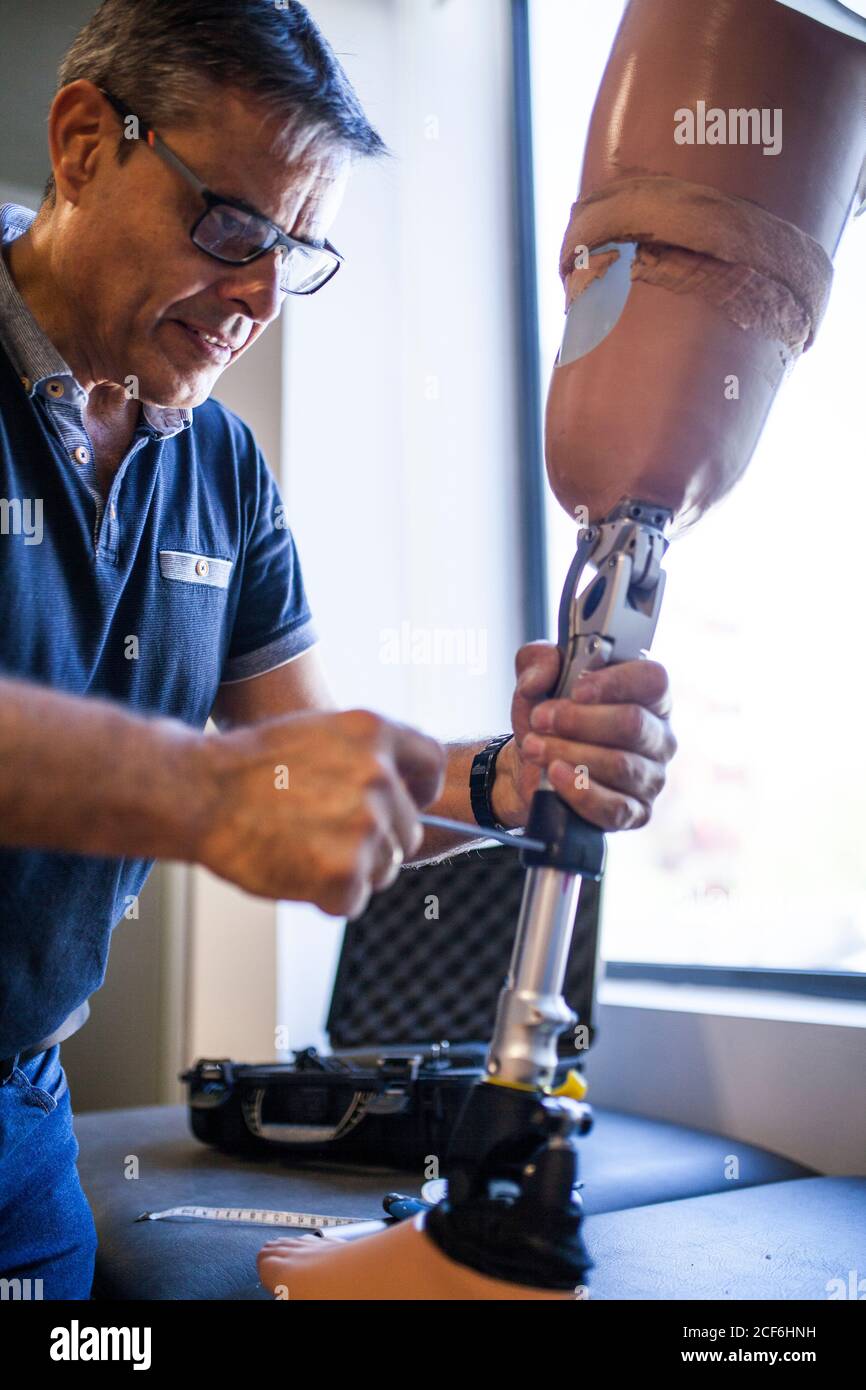 Prosthetic engineer reviewing the prosthesis of a patient and improving ...