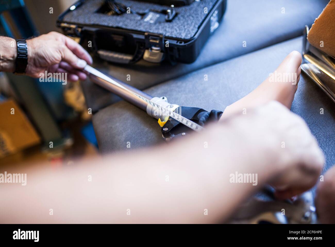 unrecognizable prosthetic engineer reviewing the prosthesis of a ...