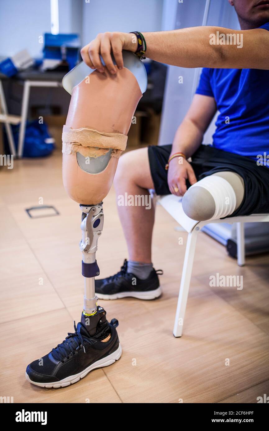 Leg amputation stump hi-res stock photography and images - Alamy