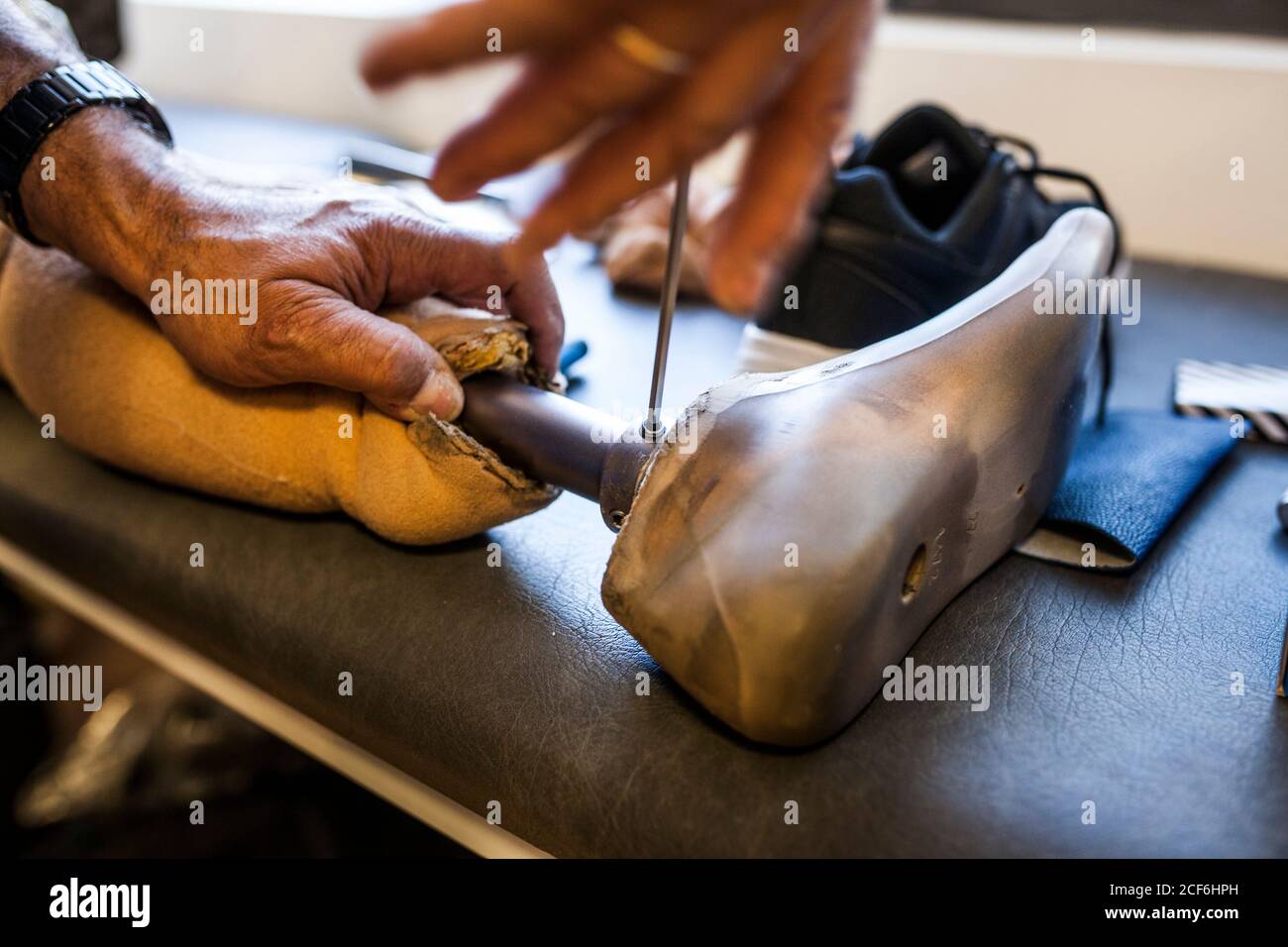unrecognizable prosthetic engineer reviewing the prosthesis of a ...