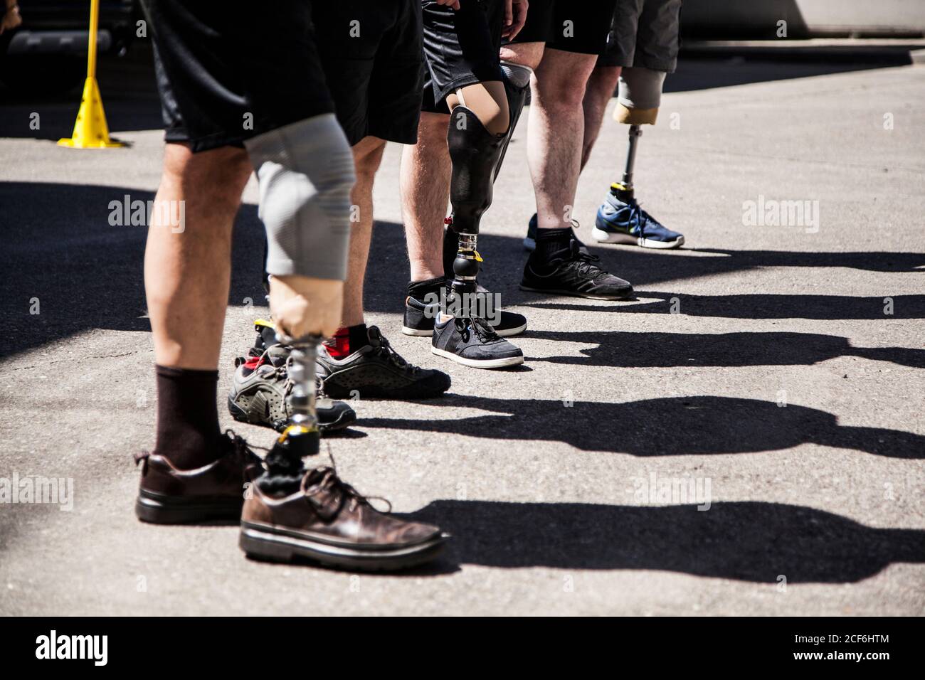 Leg Amputation Stump High Resolution Stock Photography and Images - Alamy