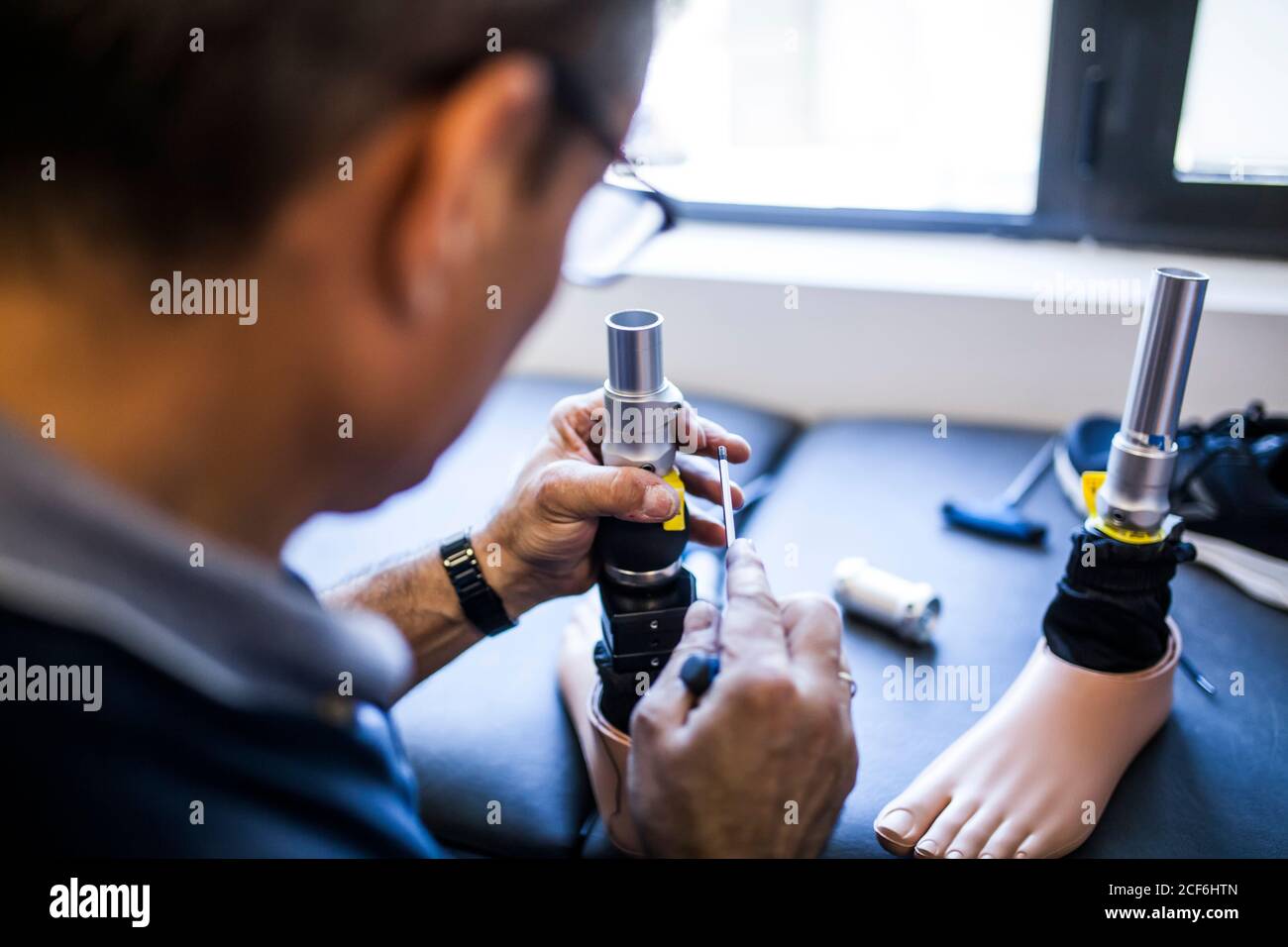 Prosthetic engineer reviewing the prosthesis of a patient and improving ...