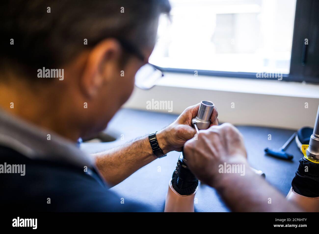 Prosthetic engineer reviewing the prosthesis of a patient and improving ...