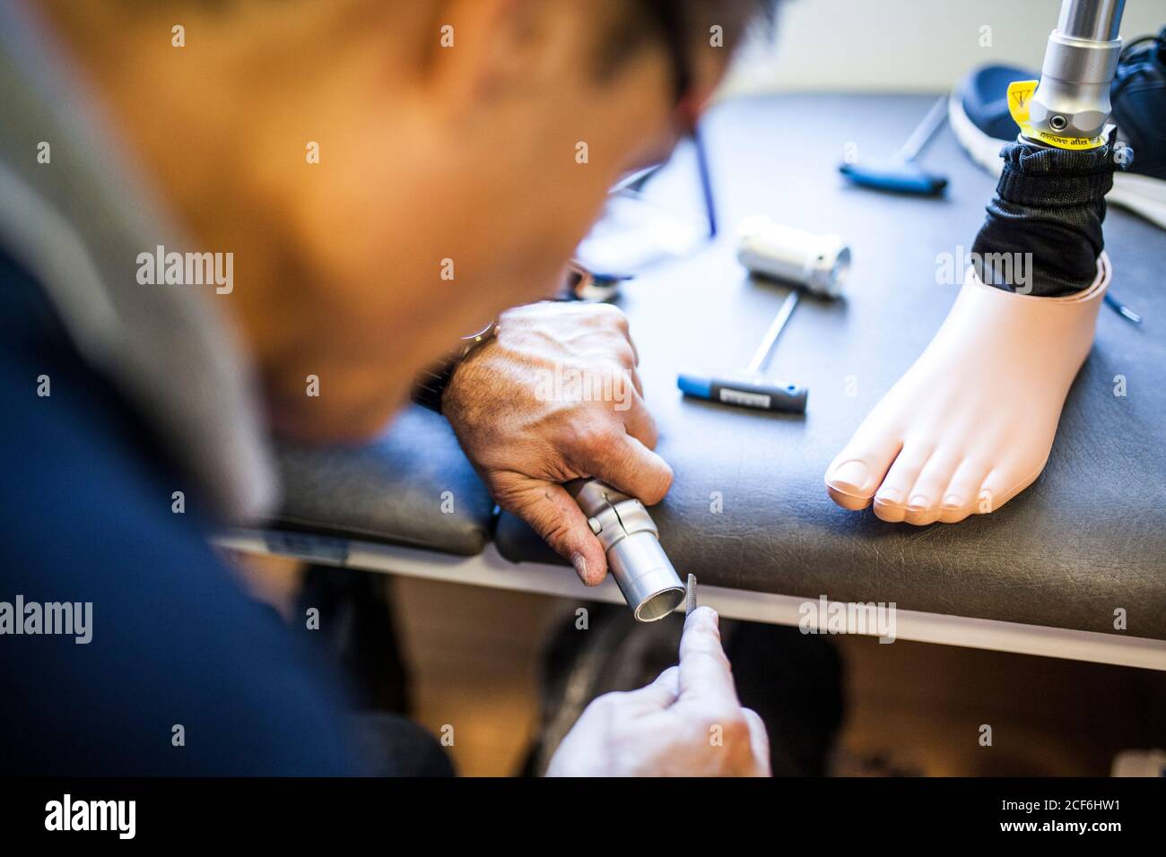 Prosthetic engineer reviewing the prosthesis of a patient and improving ...