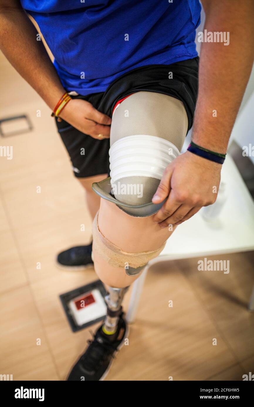 Leg amputation stump hi-res stock photography and images - Alamy