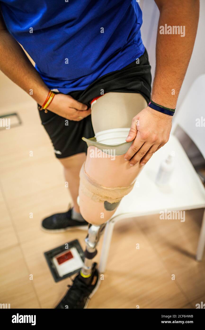 Leg Amputation Stump High Resolution Stock Photography and Images - Alamy