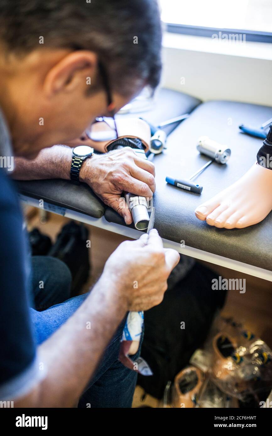 Prosthetic engineer reviewing the prosthesis of a patient and improving ...
