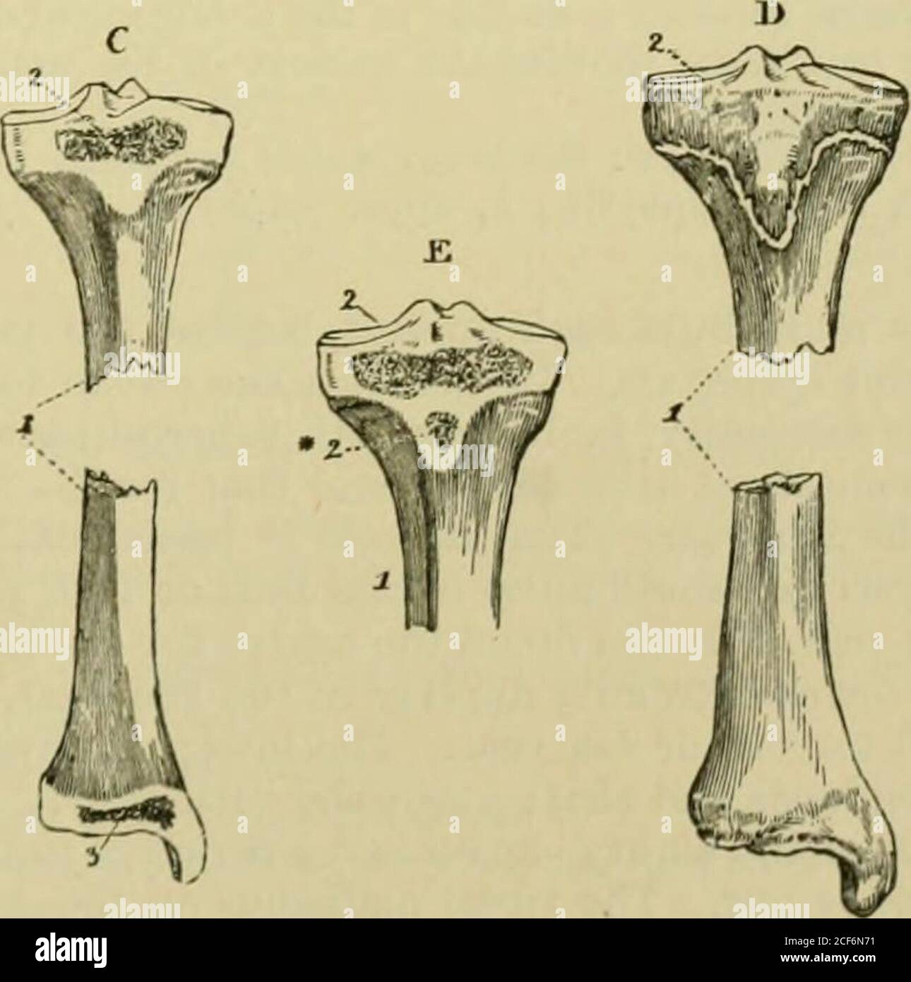 . Quain's Elements of anatomy. Fig. 160.—Ossification op the tibia. (R ...