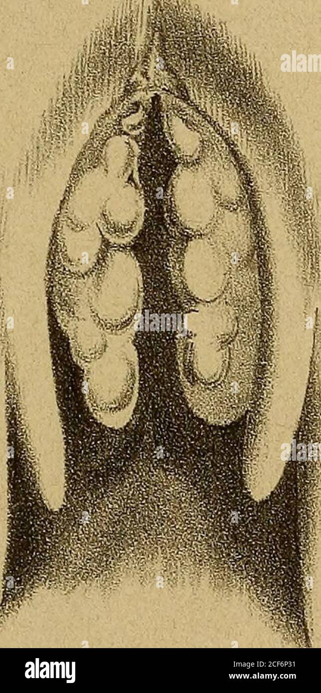 . Deformities of the mouth : congenital and acquired, with their ...
