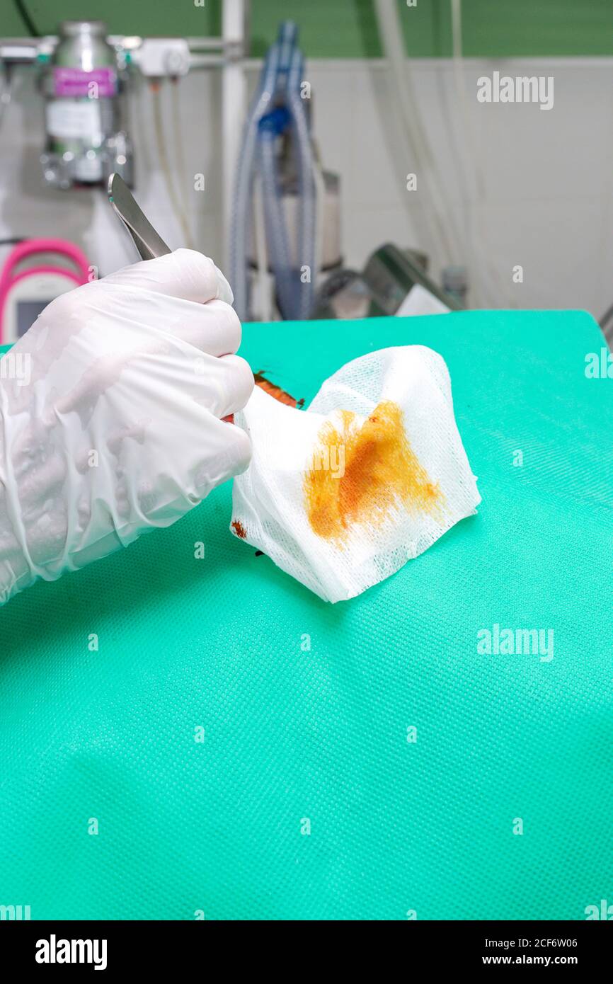 From above bloody wound on body of patient covered with green sheet ...