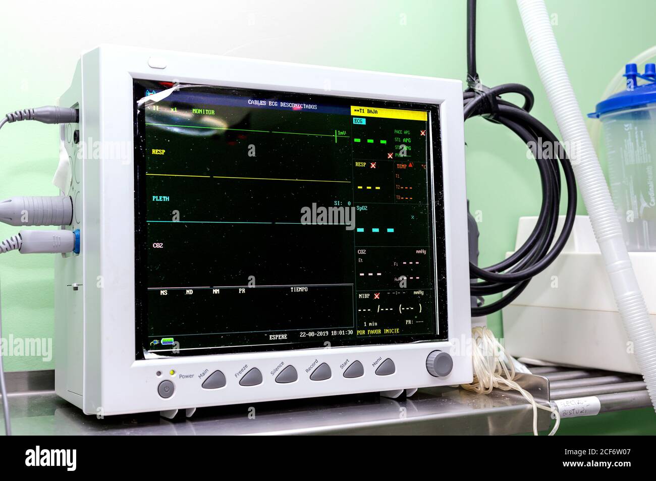 Electronic monitor displaying vital signs and heart rate of patient in ...