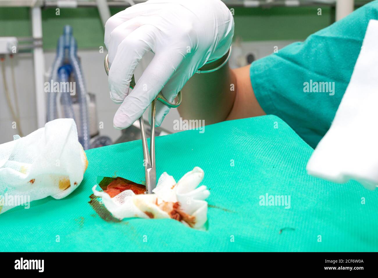 From above bloody wound on body of patient covered with green sheet ...