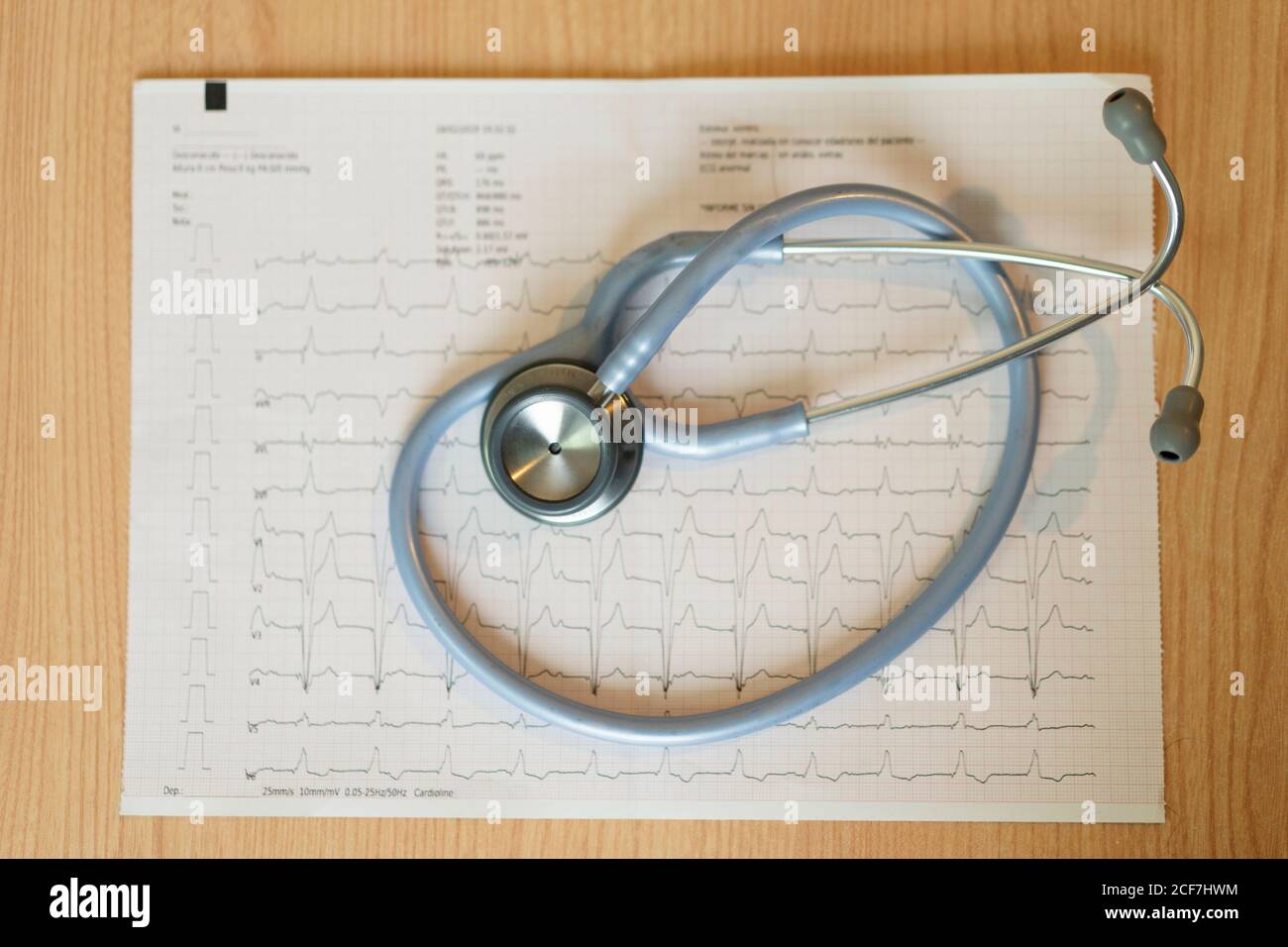 Stethoscope on graph paper hi-res stock photography and images - Alamy