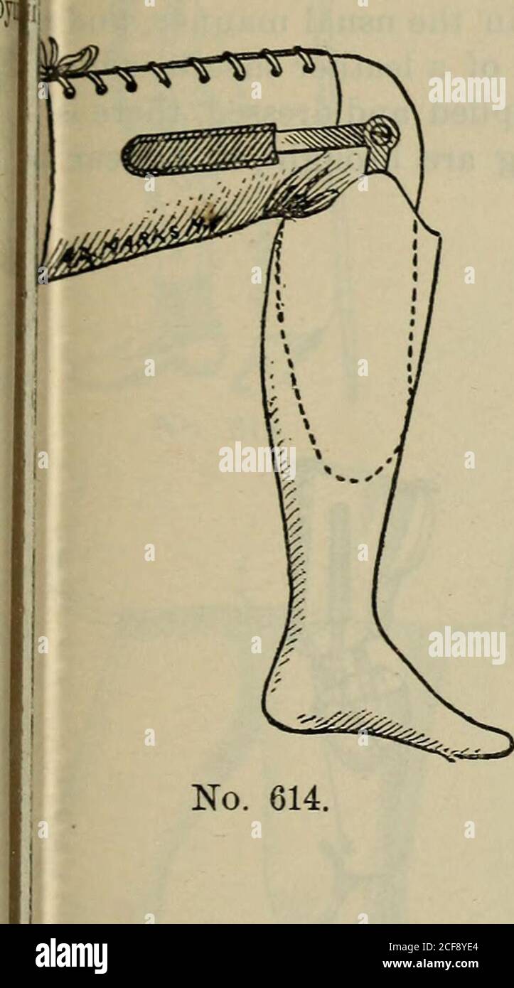 . A treatise on artificial limbs with rubber hands and feet ... ing ...