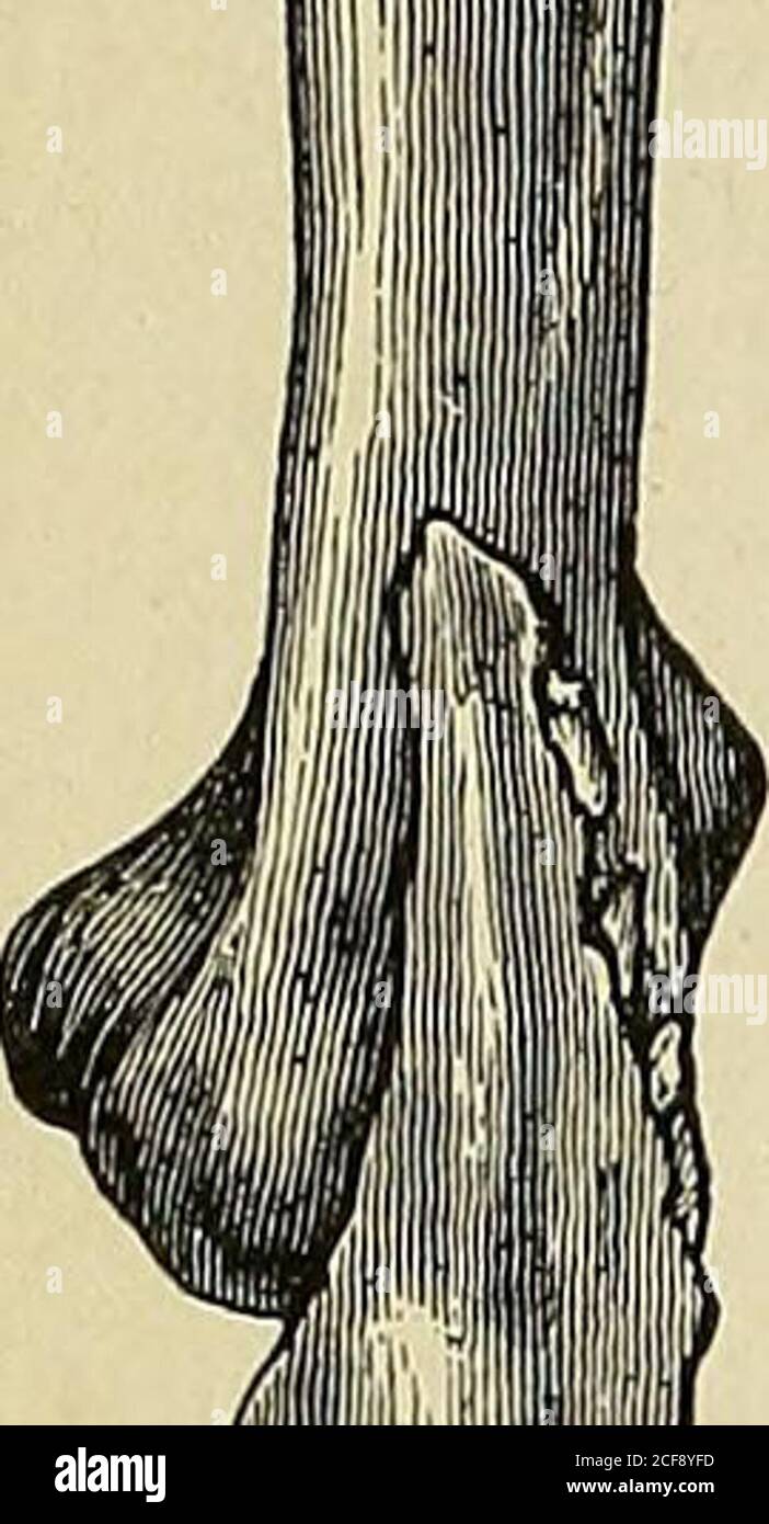 Condyloid joint hi-res stock photography and images - Alamy