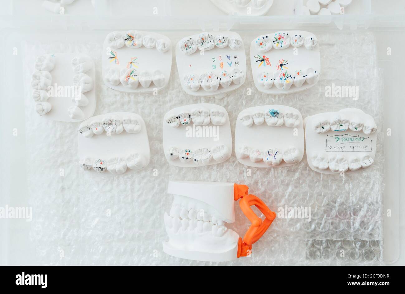 Top view of various sets of dental crowns and model of jaw for studying ...