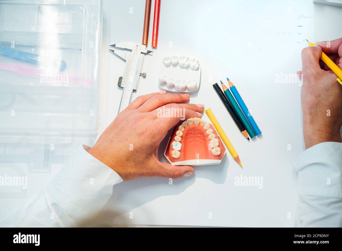 Dental mold hi-res stock photography and images - Alamy