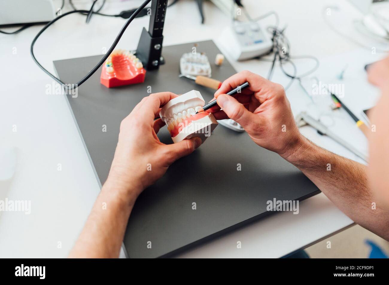 Dental mold hi-res stock photography and images - Alamy
