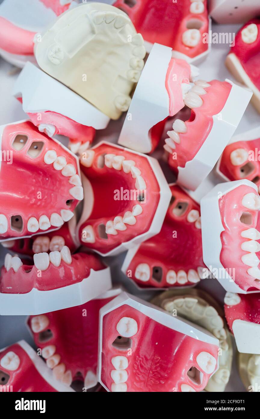 Dental models hi-res stock photography and images - Alamy
