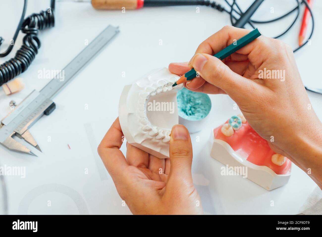 Dental mold hi-res stock photography and images - Alamy