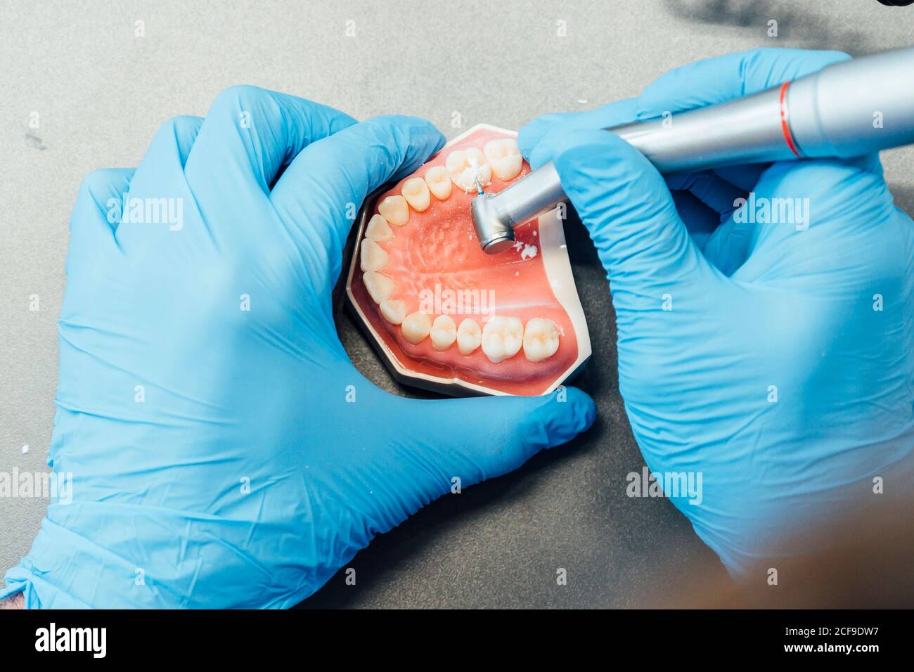 Dental study cast hi-res stock photography and images - Alamy