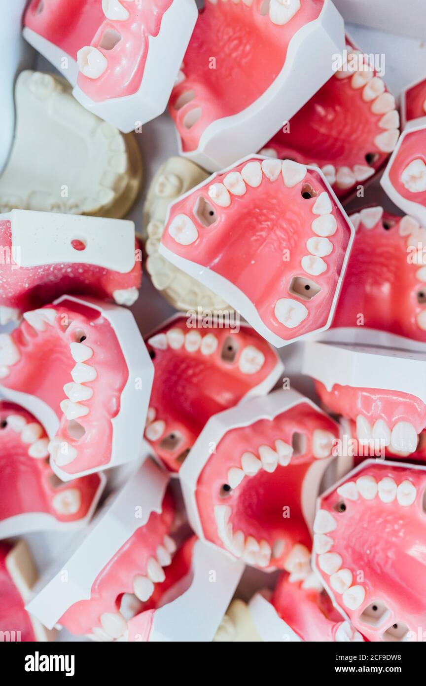 Dental impression plaster hi-res stock photography and images - Alamy