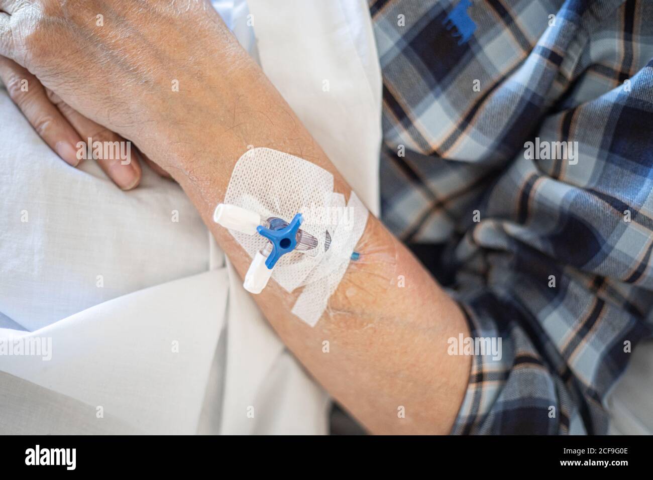 Cannula arm hi-res stock photography and images - Alamy