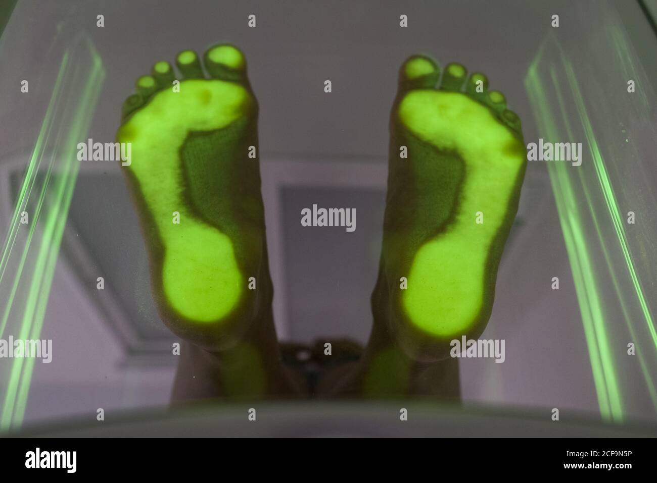 Foot step scanning of patient Stock Photo - Alamy