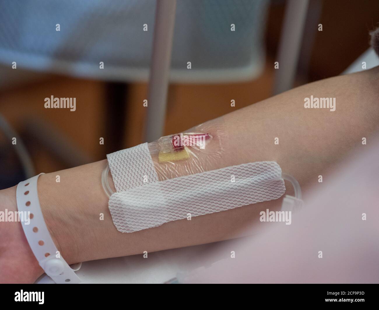 Canula drip hi-res stock photography and images - Alamy