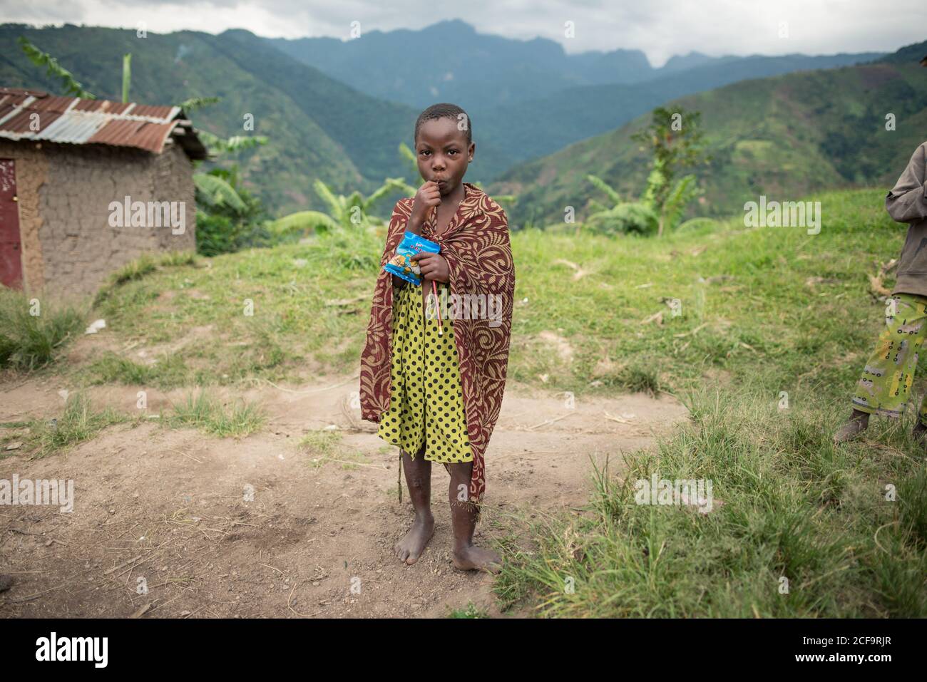 Bald kid hi-res stock photography and images - Alamy