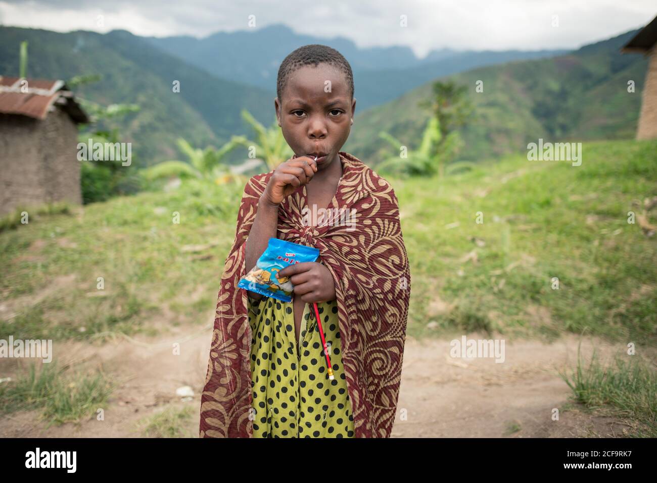 Bald Kid High Resolution Stock Photography and Images - Alamy