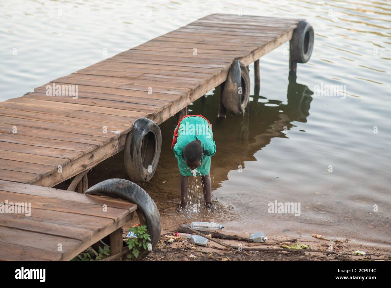 Child too thin unhealthy hi-res stock photography and images - Alamy