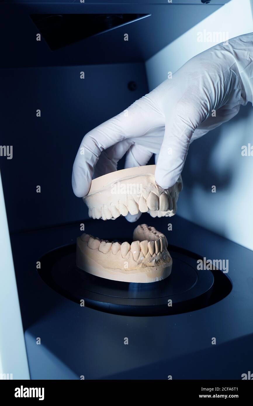 Dental study cast hi-res stock photography and images - Alamy