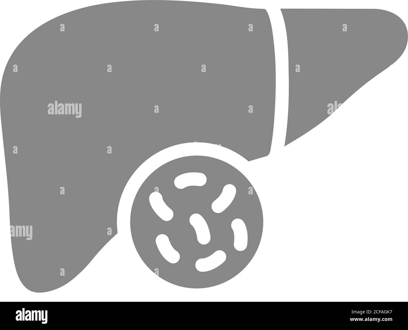 Hepatitis b Stock Vector Images - Alamy