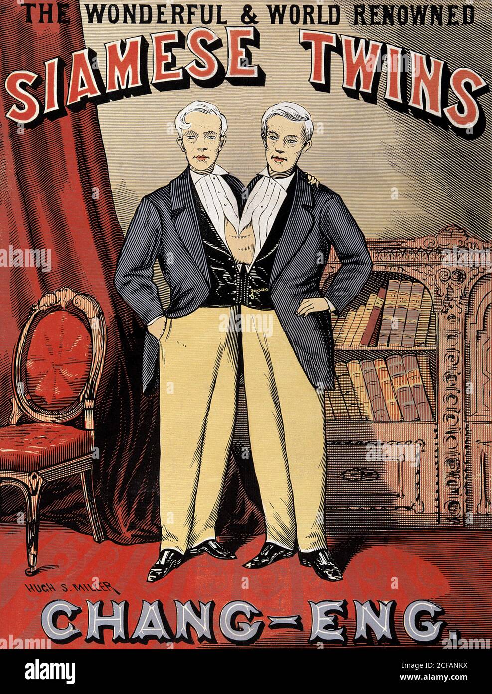 Siamese twins chang hi-res stock photography and images - Alamy