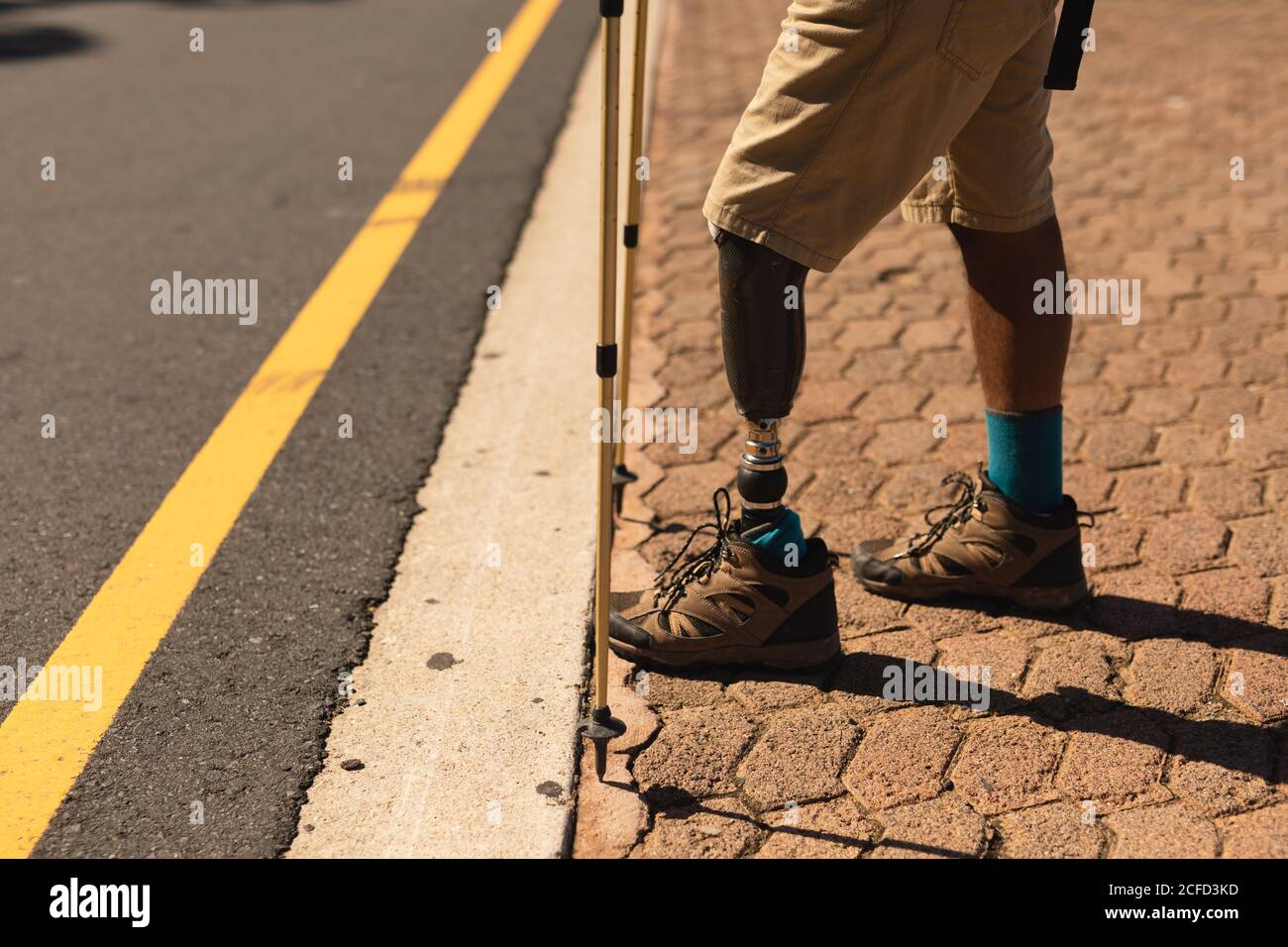 Male athlete with prosthetic leg Stock Photo - Alamy
