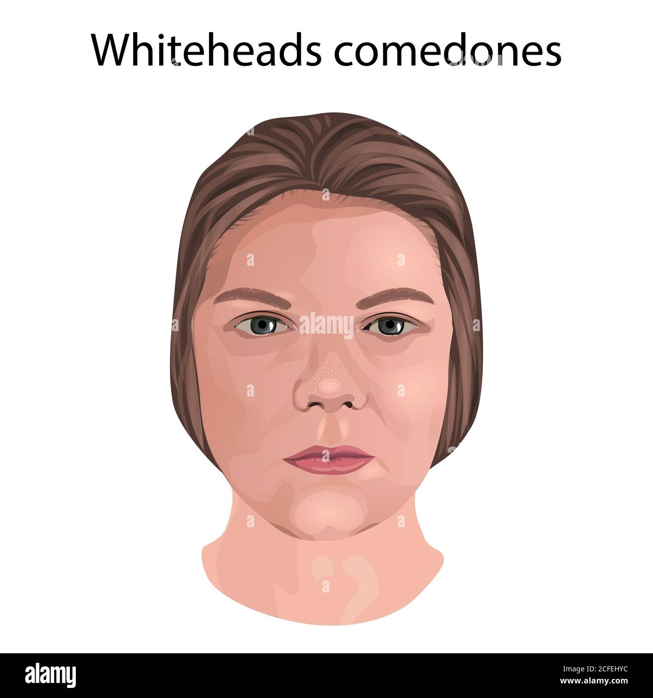 Whitehead Cut Out Stock Images & Pictures - Alamy