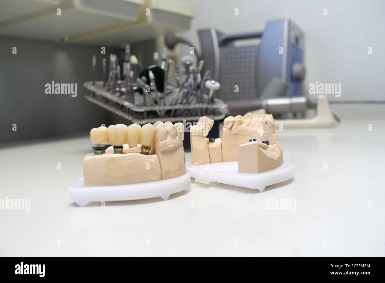 zirconia dental crowns on dental models in the dental laboratory Stock ...