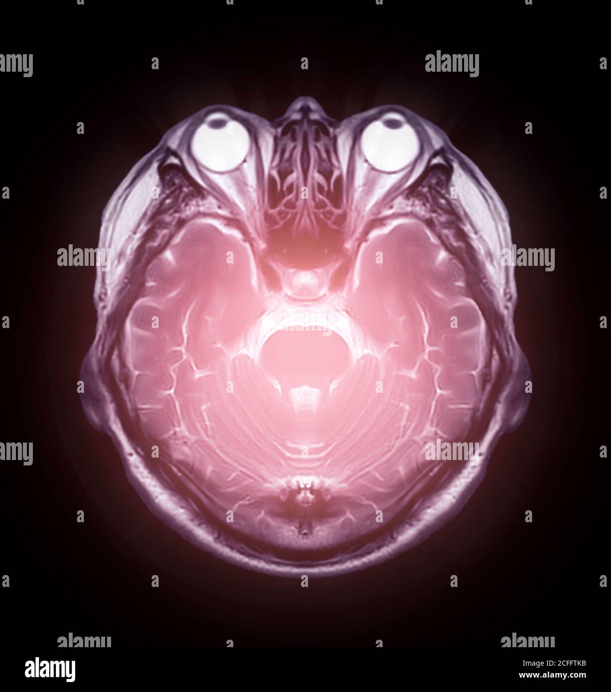 Head mri axial hi-res stock photography and images - Alamy