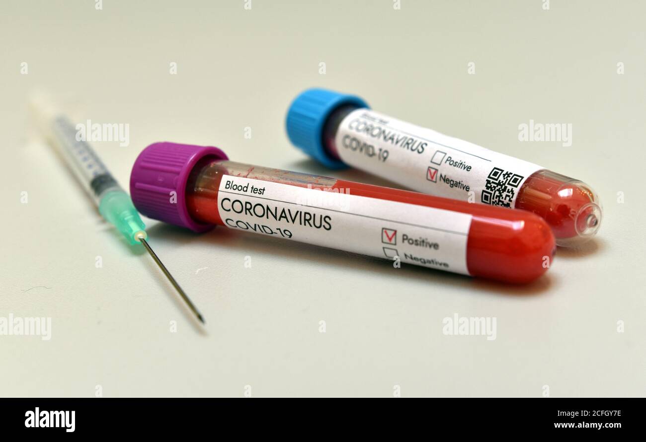 Positive blood sample test hi-res stock photography and images - Alamy